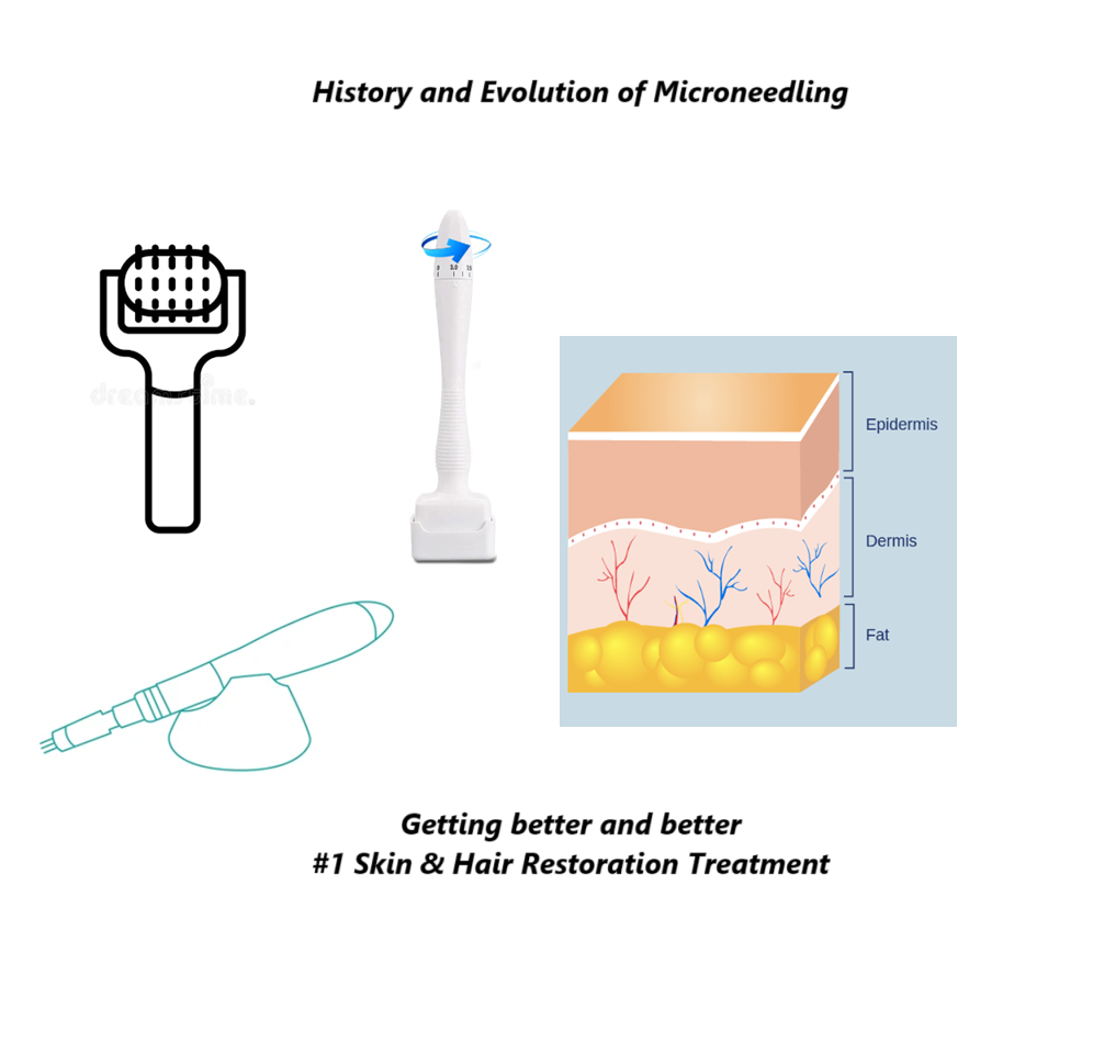 History of Evolution of Microneedling (CIT) – Grandeur Global