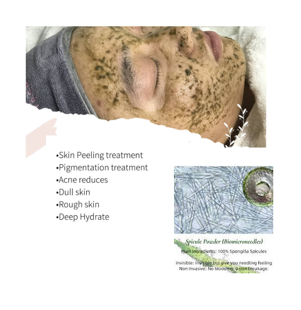 SpongillaTech® Algae Peel (Professional Home Peel Bulk Package ...